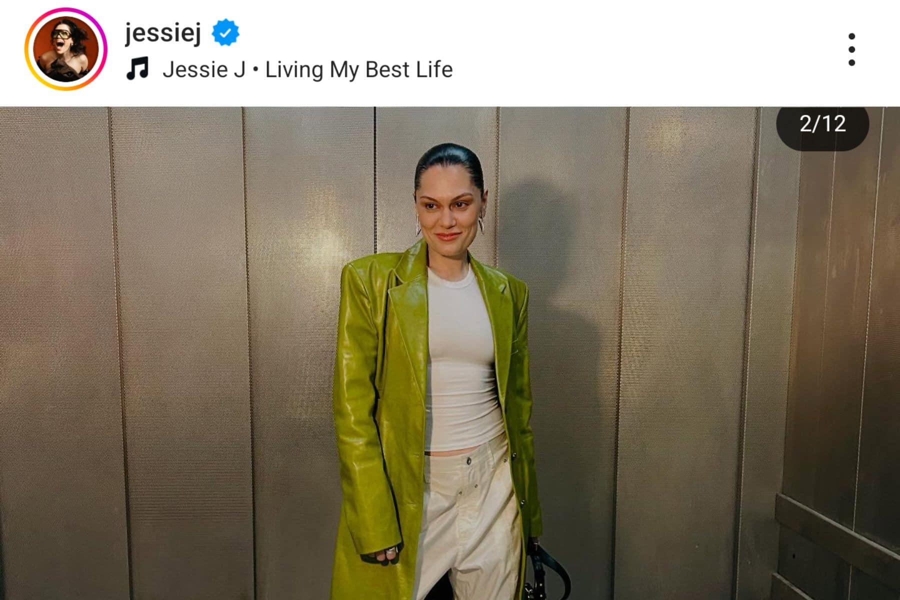Jessie J Jokes About The Timing Of Her Breast Cancer Diagnosis